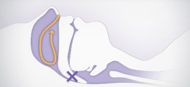 ApneaRx | Advancing the Science of Sleep